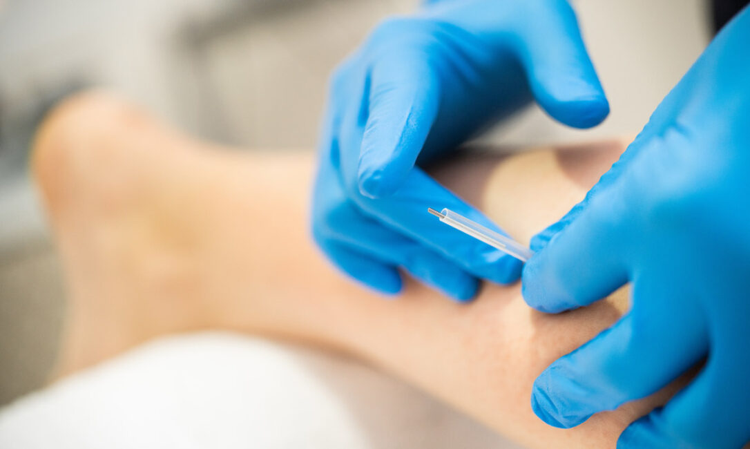 Home - Apex Physical Therapy